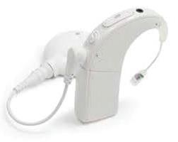 Thinking about a cochlear implant? - South Tees Hospitals NHS ...