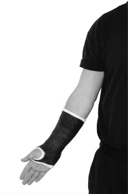 Advice for patients in a forearm cast - South Tees Hospitals NHS ...