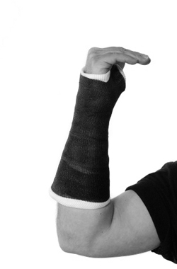 Advice for patients in a forearm cast - South Tees Hospitals NHS ...