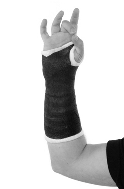 Advice for patients in a forearm cast - South Tees Hospitals NHS ...