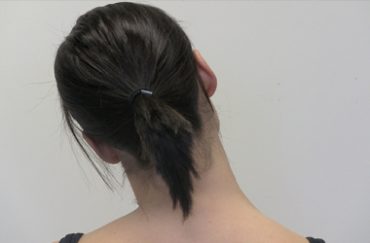 Cervical spine active range of movement left side flexion - South Tees ...