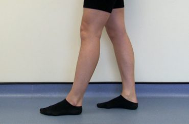 Lateral wall slides - South Tees Hospitals NHS Foundation Trust