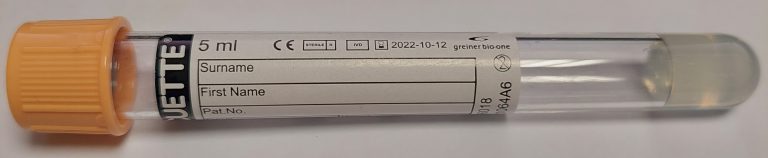 Blood bottles - South Tees Hospitals NHS Foundation Trust