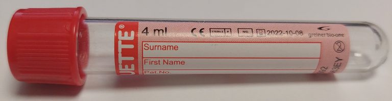 Blood bottles - South Tees Hospitals NHS Foundation Trust