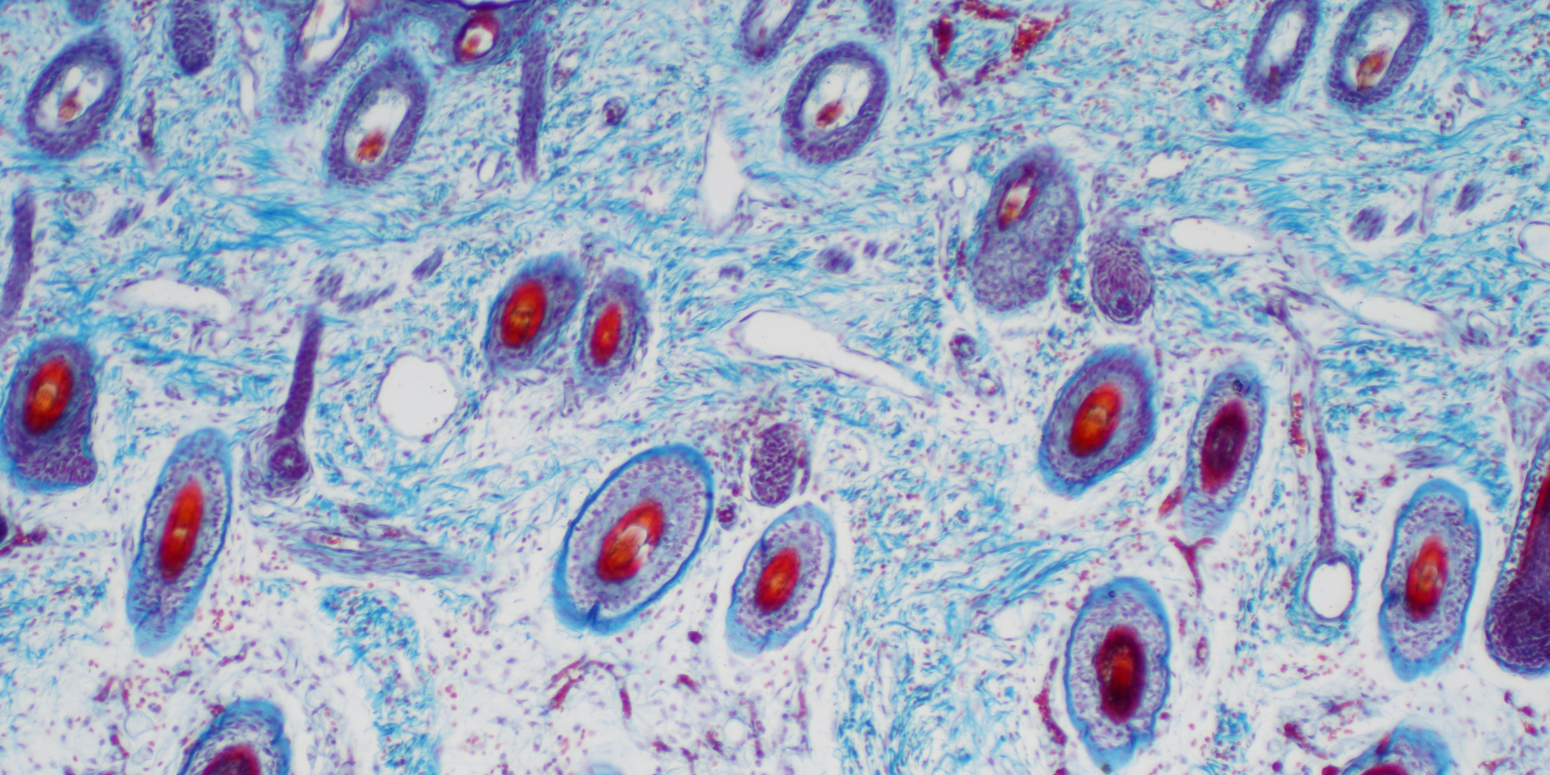Types of Cancer - South Tees Hospitals NHS Foundation Trust