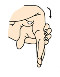 Carpel tunnel syndrome (CTS) in pregnancy - South Tees Hospitals NHS ...