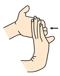 Carpel tunnel syndrome (CTS) in pregnancy - South Tees Hospitals NHS ...