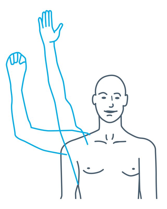 Neck dissection – Treatment and aftercare - South Tees Hospitals NHS ...