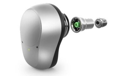 How to look after your bone conducting hearing implant (BCHI) - South ...