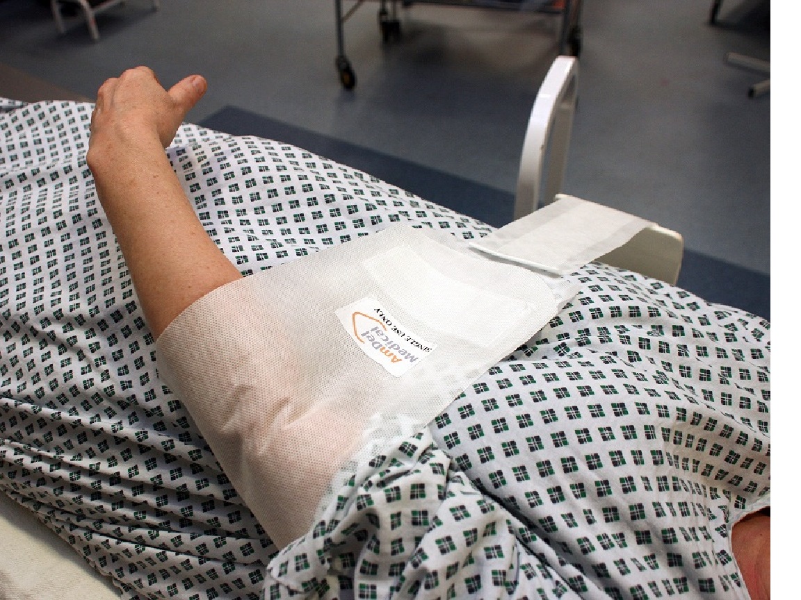 AmDel Medical Left Radial Support Sling - South Tees Hospitals NHS ...