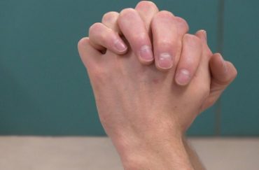 Wrist ROM (range of movement) - South Tees Hospitals NHS Foundation Trust