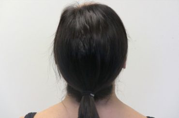 Cervical spine - Active range of movement - South Tees Hospitals NHS ...