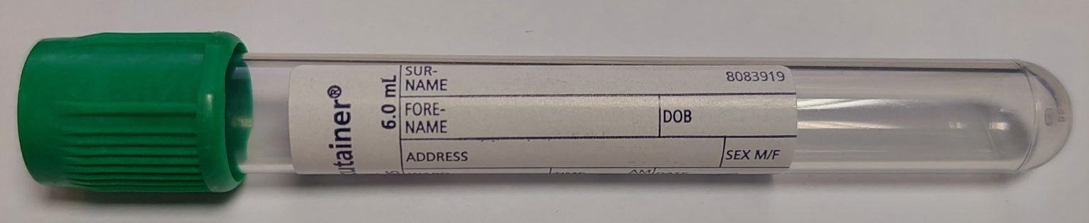 Blood bottles - South Tees Hospitals NHS Foundation Trust