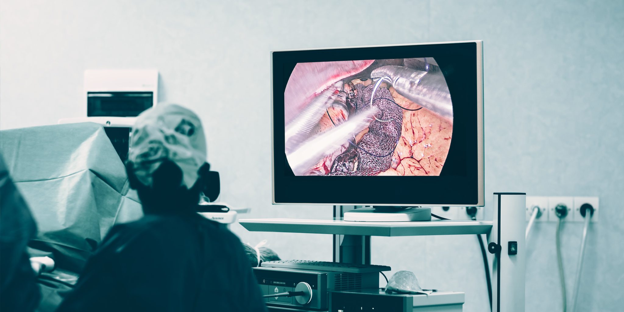 Roux en y gastric bypass - South Tees Hospitals NHS Foundation Trust