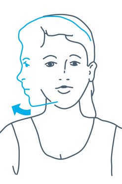 Neck dissection – Treatment and aftercare - South Tees Hospitals NHS ...