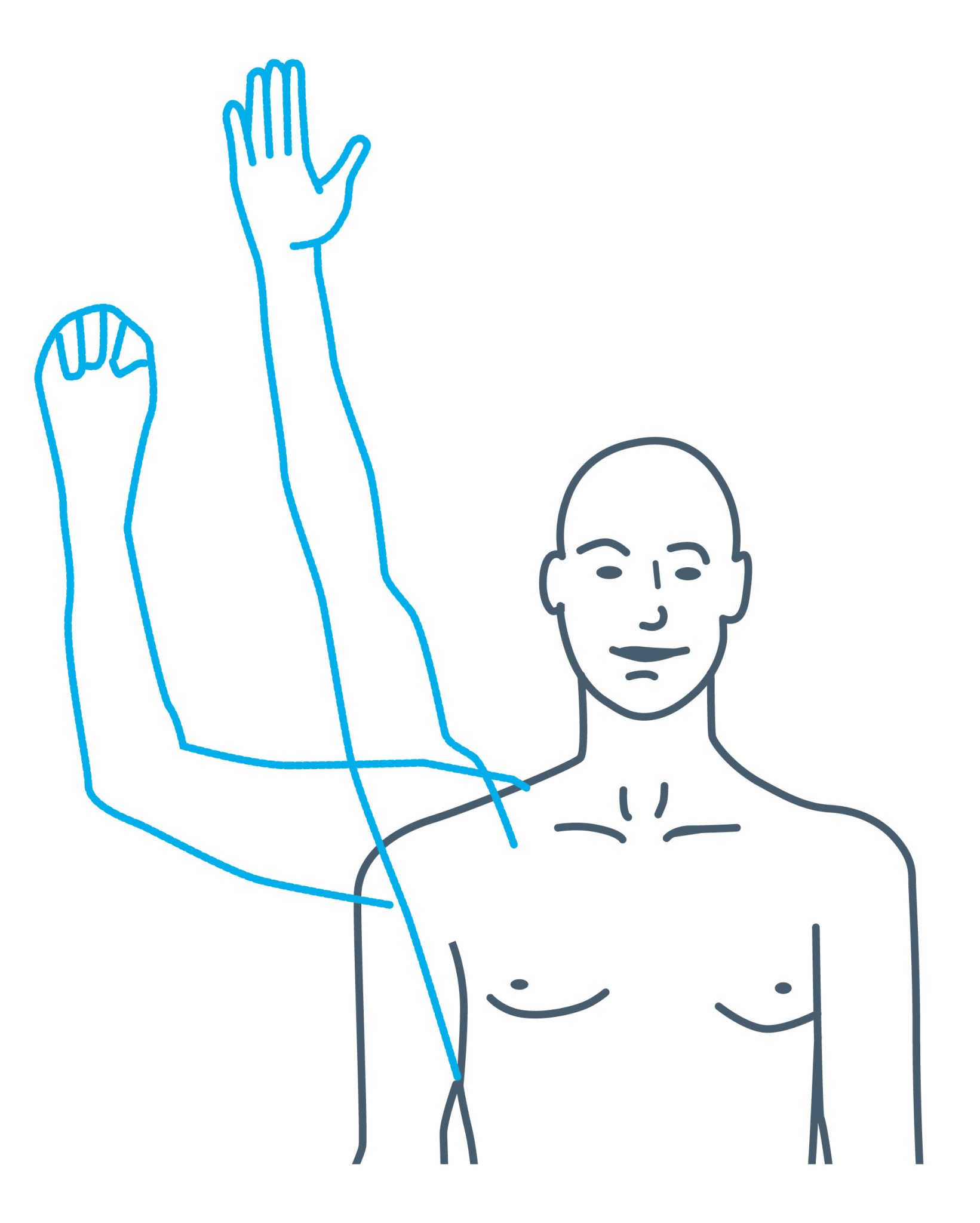Neck dissection – Treatment and aftercare - South Tees Hospitals NHS ...