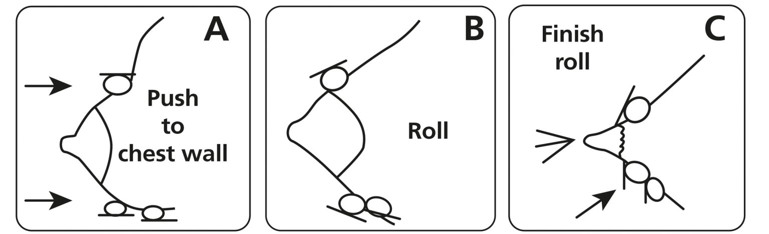 Expressing colostrum during pregnancy - South Tees Hospitals NHS ...