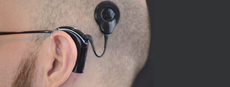 Adult rehabilitation, switch-on and tuning following cochlear ...