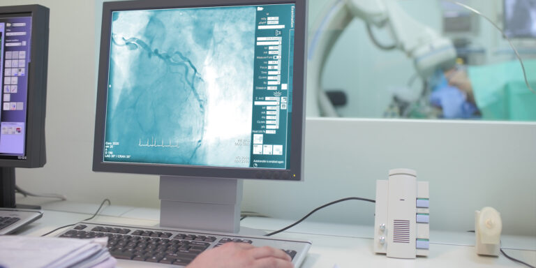 Coronary angiography - South Tees Hospitals NHS Foundation Trust