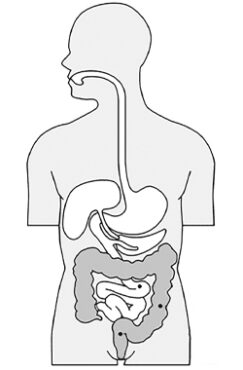 Proctogram - South Tees Hospitals NHS Foundation Trust