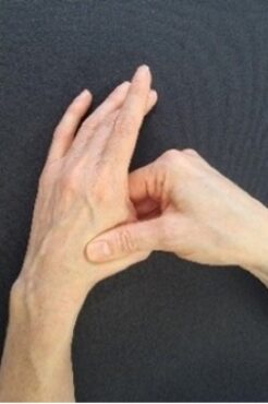 Advice and Exercises Following Trapeziectomy - South Tees Hospitals NHS ...