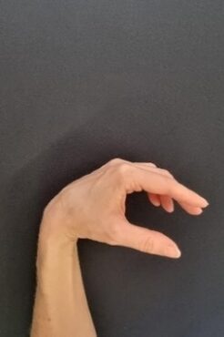 Advice and Exercises Following Trapeziectomy - South Tees Hospitals NHS ...